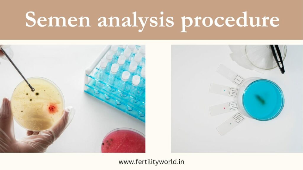 SEMEN ANALYSIS TEST COST | FERTILITYWORLD