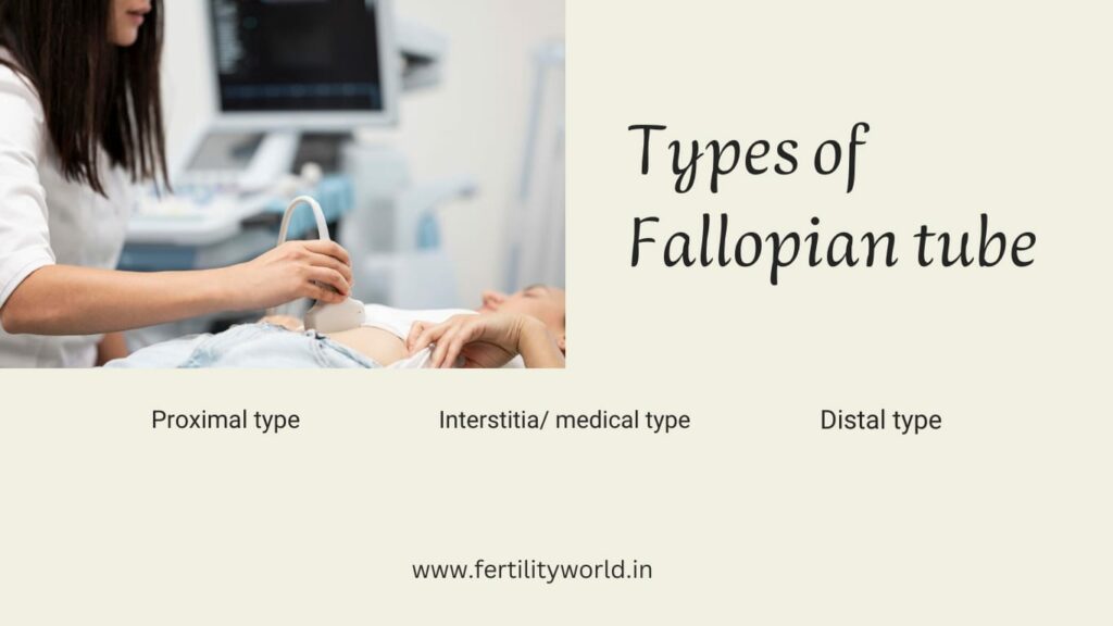 BLOCKED FALLOPIAN TUBE - Fertilityworld