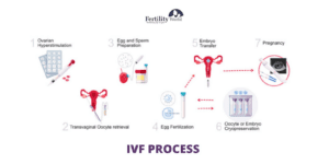 CHEAPEST IVF IN THE WORLD | FERTILITYWORLD