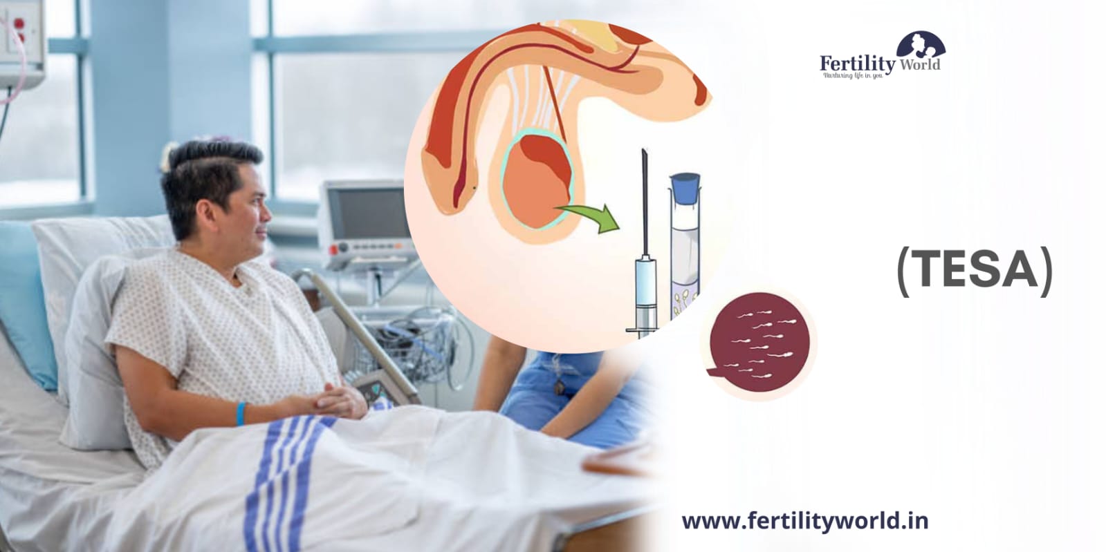 BEST INFERTILITY CENTRE IN HYDERABAD | FERTILITYWORLD